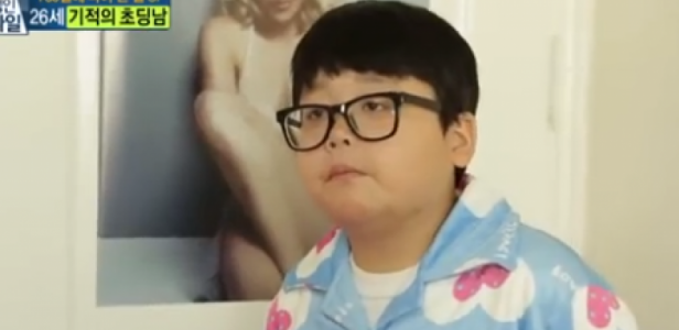 Atteint du syndrome d’Highlander, ce Coréen ne vieillit pas - Allo-Médecins